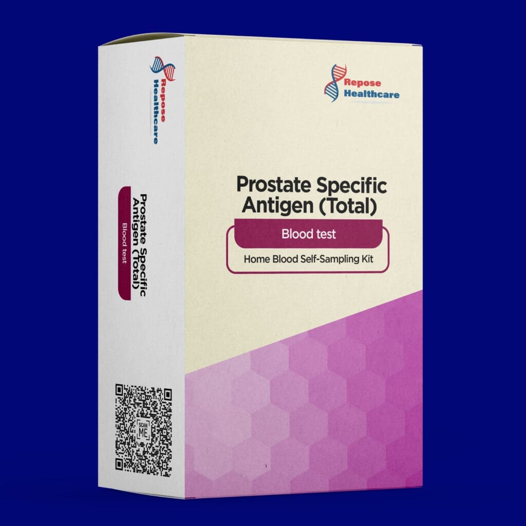 Prostate Specific Antigen Test | Fast & Reliable Health Insight