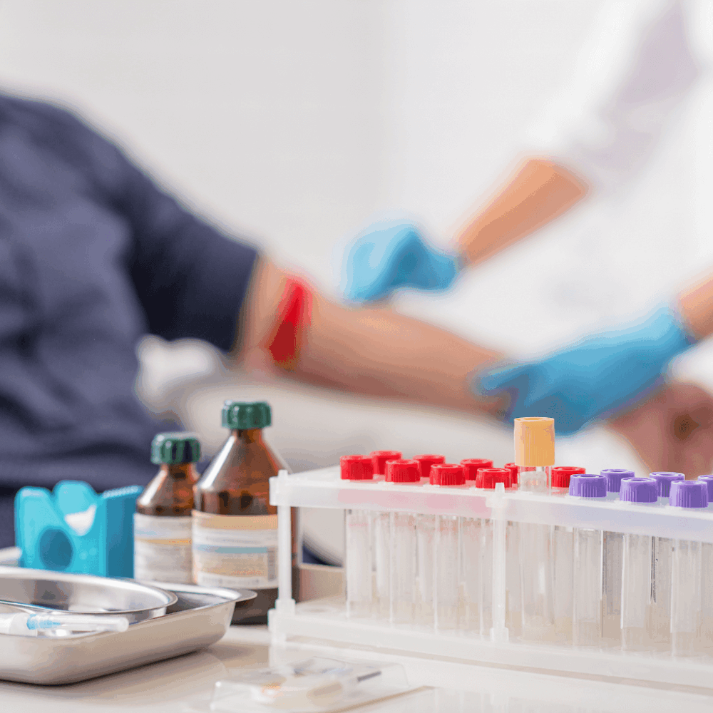 Pre-Surgery Blood Tests Explained – What Tests to do